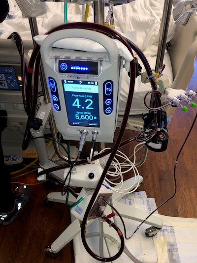 South Texas Health System Heart to Launch the Rio Grande Valley's First Lifesaving ECMO Program ...